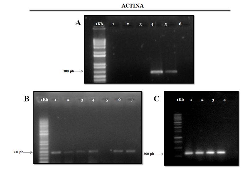 Evaluación de tres protocolos para la extracción rápida de ARN total de ...