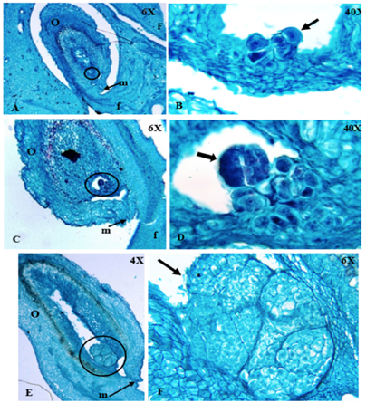Parthenocarpic and Stenospermocarpic Mango Fruits: A Review of Possible ...