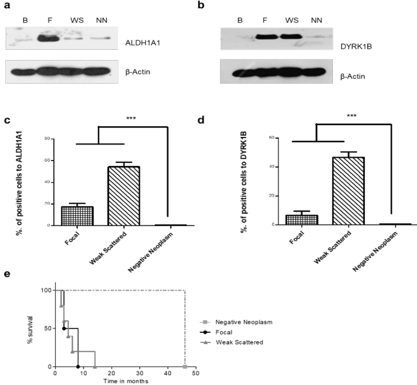 Different levels of expression of ALDH1A1 and DYRK1B in patients with ...