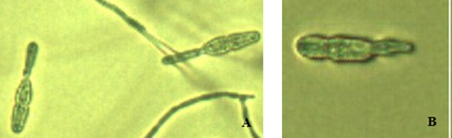 Sensibilidad in vitro de Pseudocercospora fijiensis (morelet) a los ...