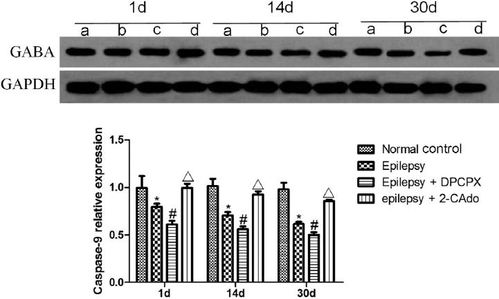 Adenosine A1 Receptor Agonist Protects Against Hippocampal Neuronal ...