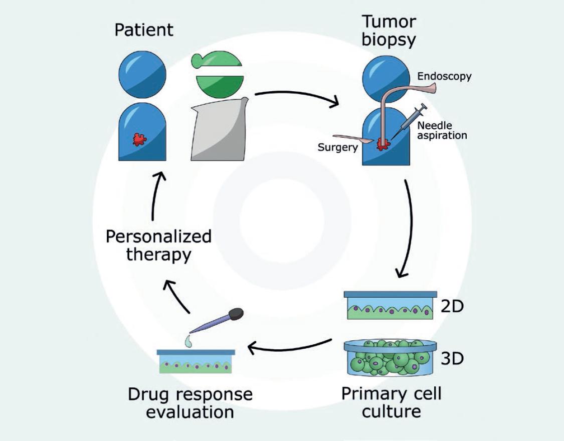 Deriving Primary Cancer Cell Cultures for Personalized Therapy