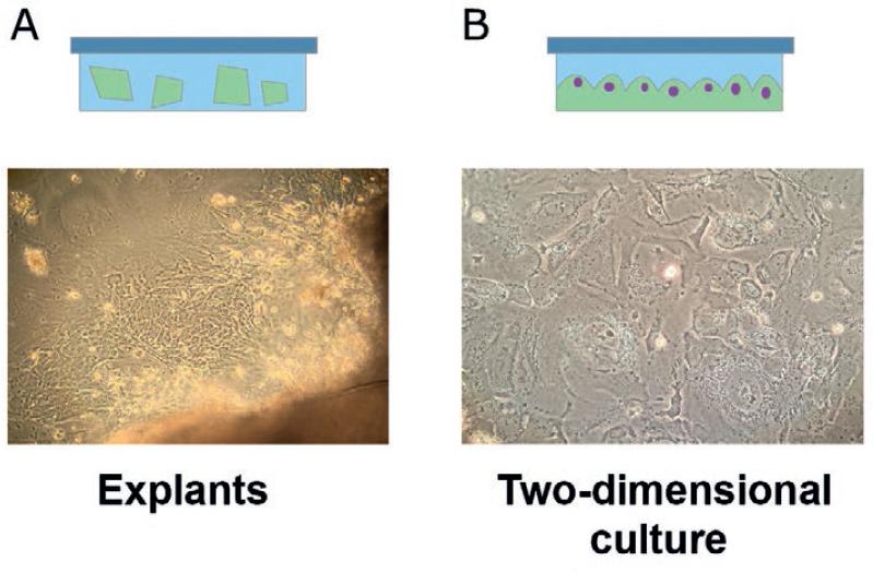 Deriving Primary Cancer Cell Cultures for Personalized Therapy