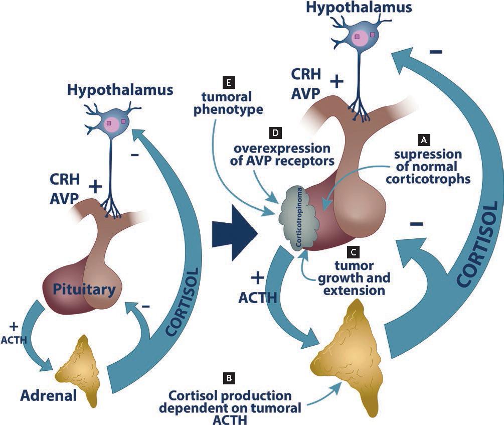 Determinants of Clinical Behavior and Prognosis in Cushing's Disease: A ...
