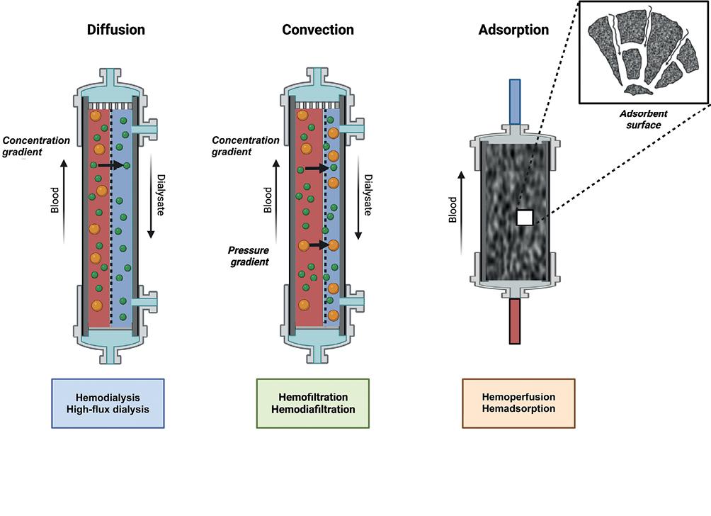 Pushing the Boundaries of Hemodialysis: Innovations in Membranes and ...