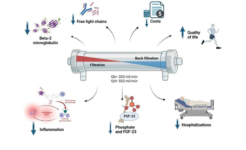 Are Medium Cut-off Membranes the Future, or the Promising Reality for ...