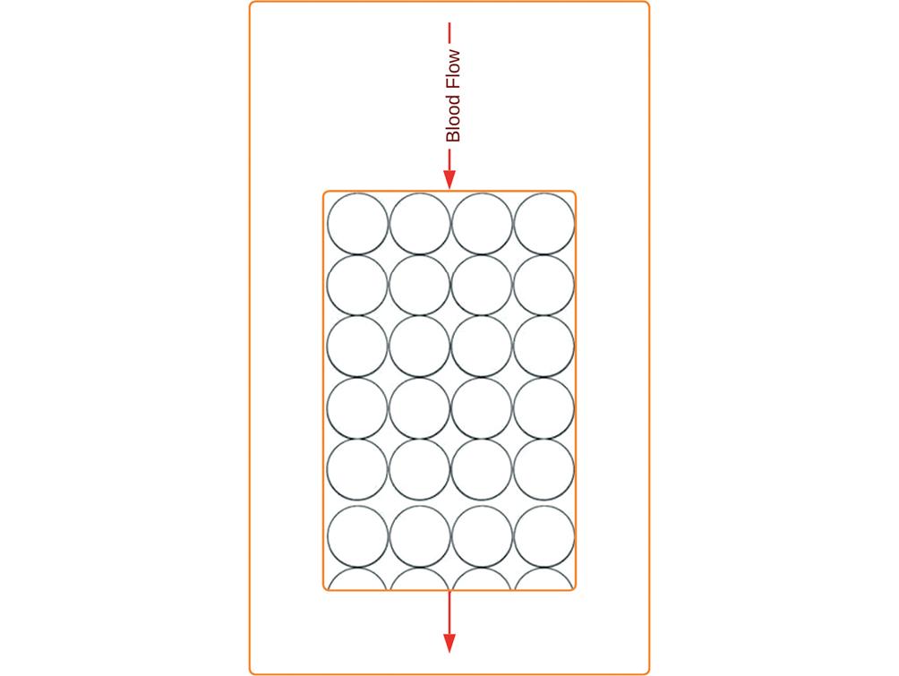 Adsorptive Therapies in Sepsis and Inflammation: Description of the ...