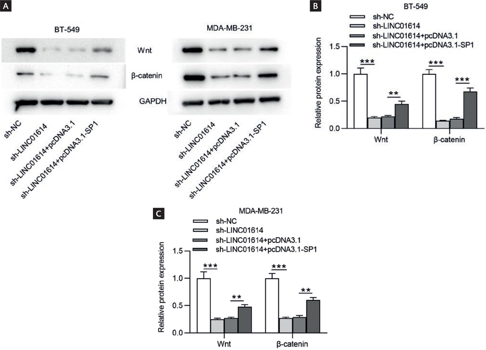 LINC01614 Activated by SP1 Promoted Malignant Behavior of Triple ...