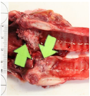 Papilomatosis laríngea: presentación de un caso de necrocirugía