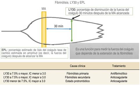 Tromboelastografía para cirugía general