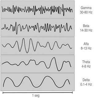Electroencefalografía básica para monitores de profundidad anestésica