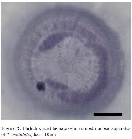 Trichodina mutabilis (Protozoa: Ciliophora: Trichodinidae) from the ...