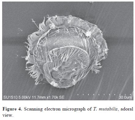 Trichodina mutabilis (Protozoa: Ciliophora: Trichodinidae) from the ...