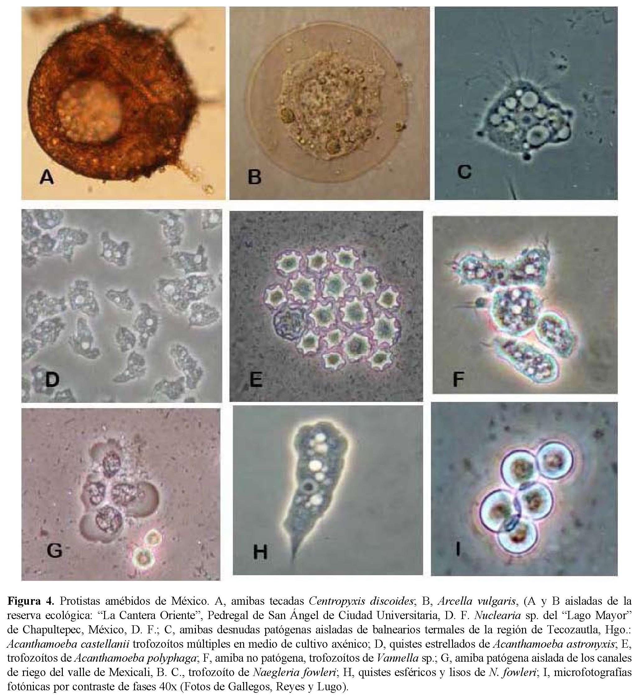 Biodiversidad de protistas amébidos de vida libre en México