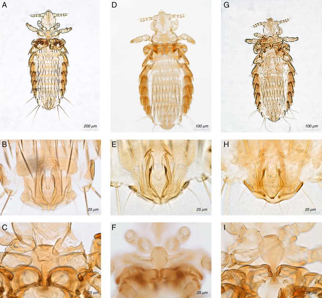 Anoplurans (Insecta: Psocodea: Anoplura) associated with rodents ...