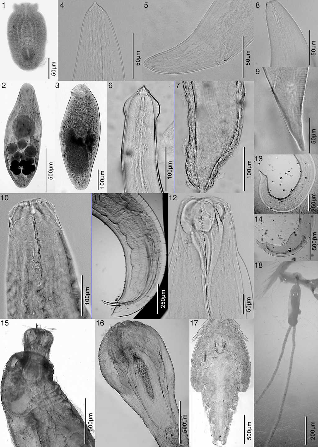 Macroparasites of silversides (Atherinopsidae: Odontesthes) in Argentina