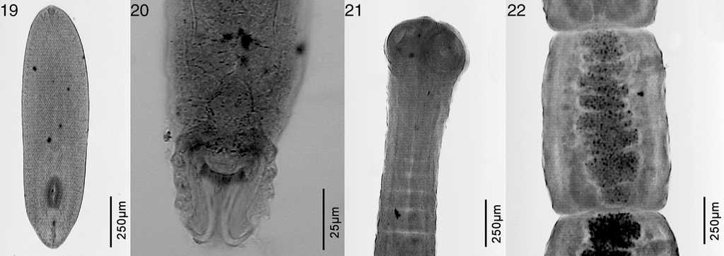Macroparasites of silversides (Atherinopsidae: Odontesthes) in Argentina