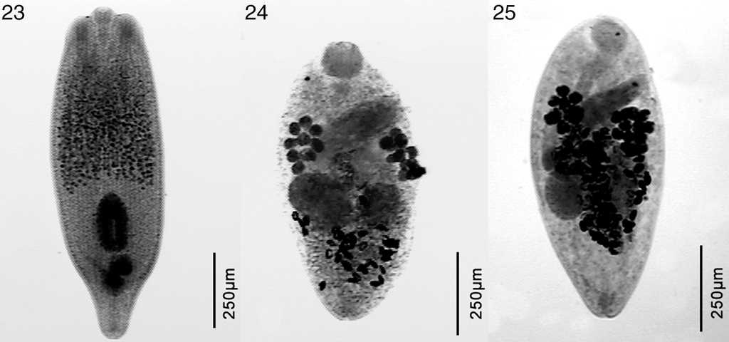 Macroparasites of silversides (Atherinopsidae: Odontesthes) in Argentina