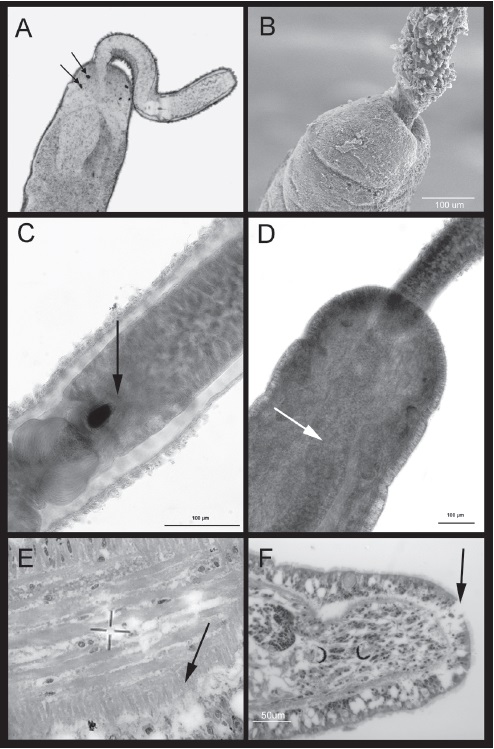 Rediscovery of the nemertean Prostoma graecense from Xochimilco, 75 ...