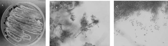 First reports of Zoophthora radicans (Entomophthoraceae) and ...