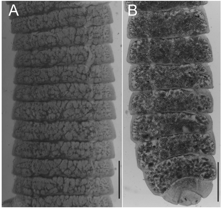Hymenolepis ackerti n. sp. (Eucestoda: Hymenolepididae) infecting ...