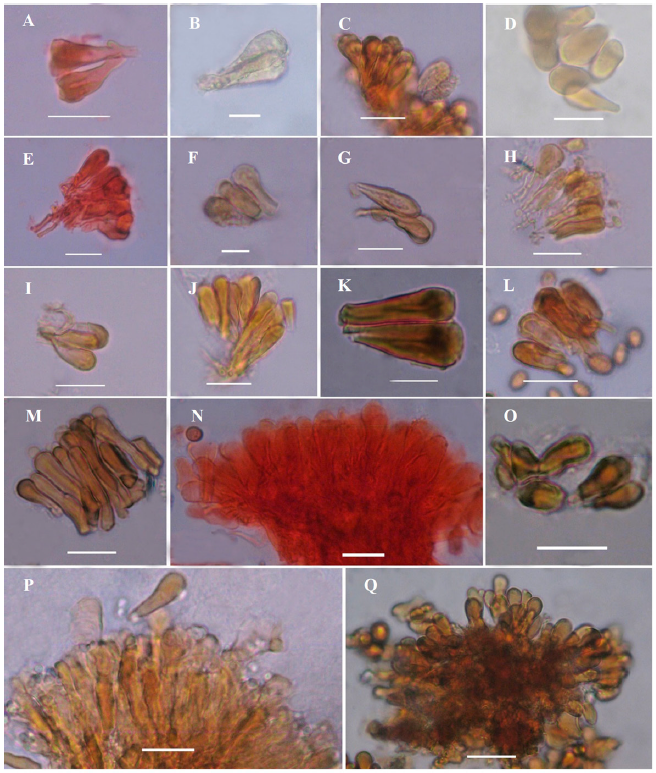 Registros nuevos del género Ganoderma (Agaricomycetes: Polyporales ...