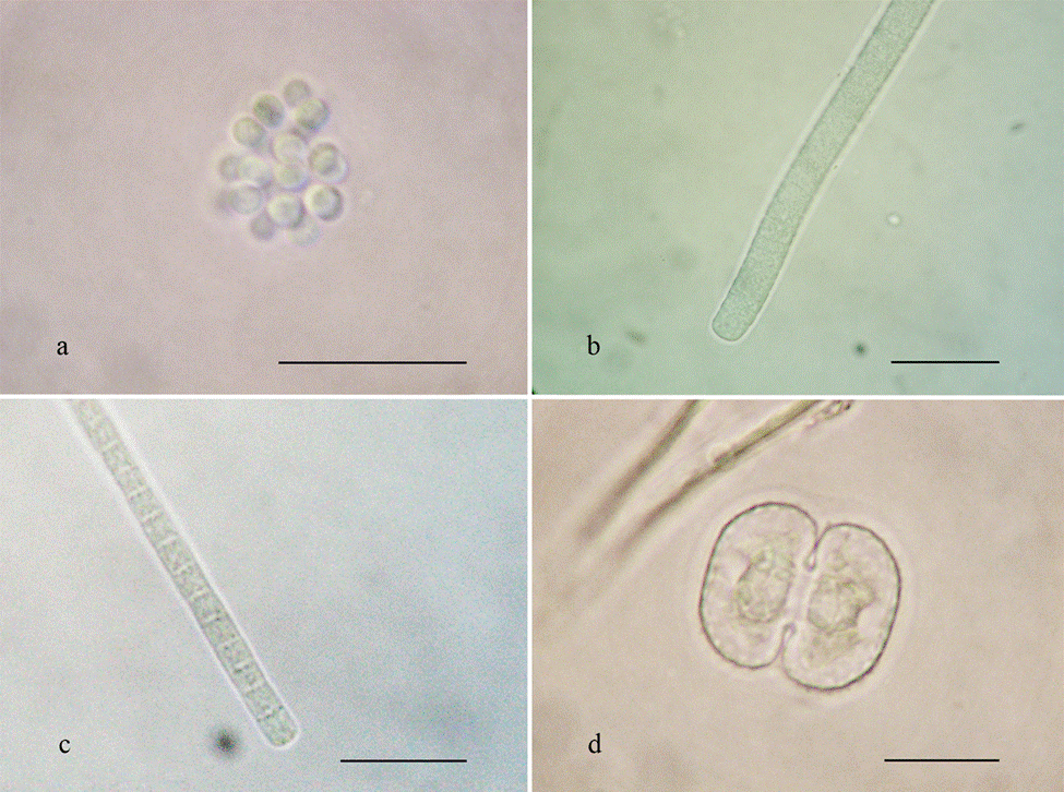 Cianoprocariontes y microalgas de dos lagunas de la Reserva de la ...