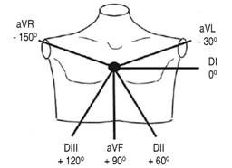 Electrocardiographic analysis of V1-V4 leads in infarction by proximal ...