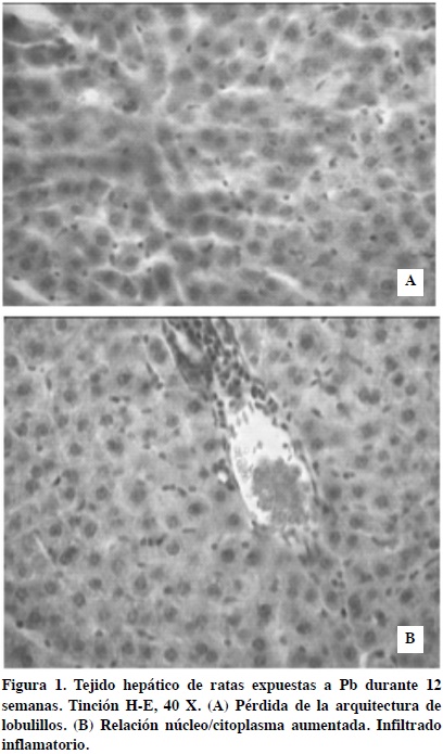 Hepatotoxicidad por exposición a plomo y su protección con tiamina y ...