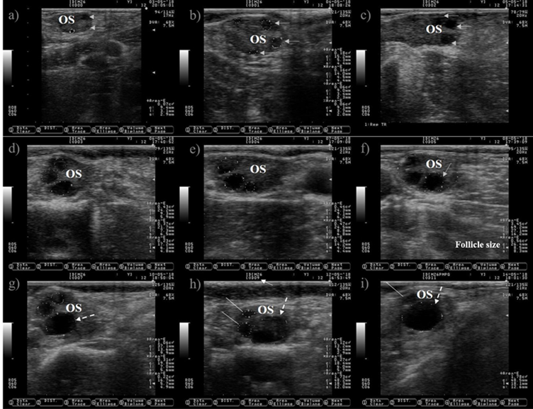 Ultrasonography and physiological description of essential events for ...