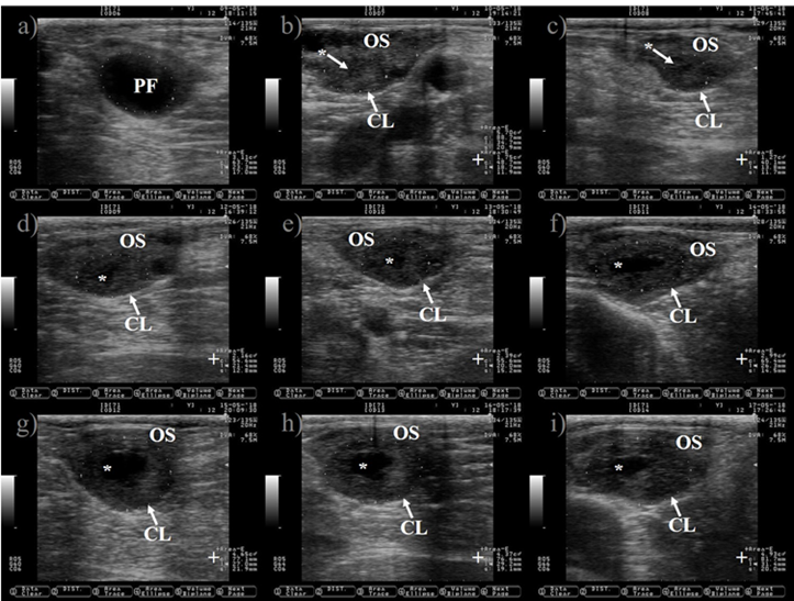 Ultrasonography and physiological description of essential events for ...