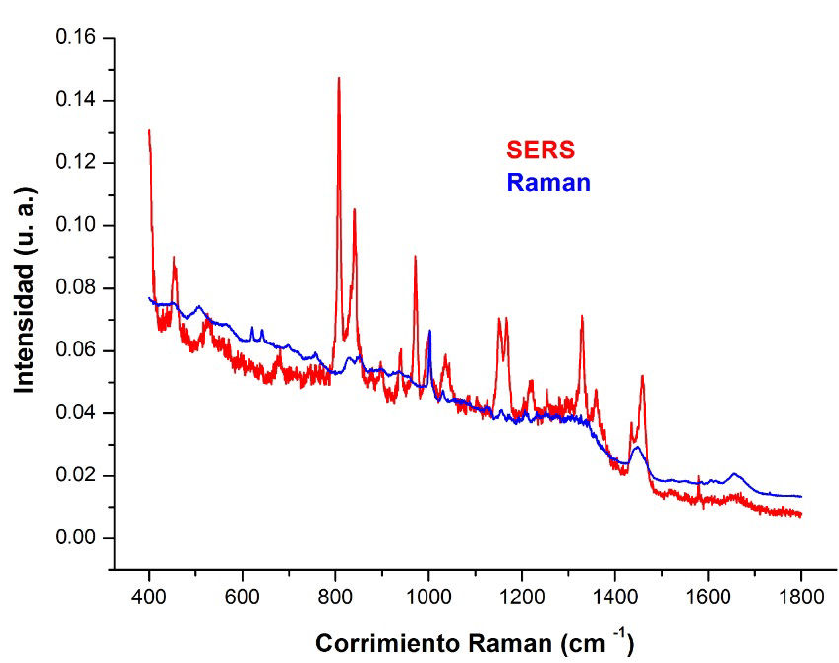Cervical cancer detection based on serum sample surface enhanced Raman ...