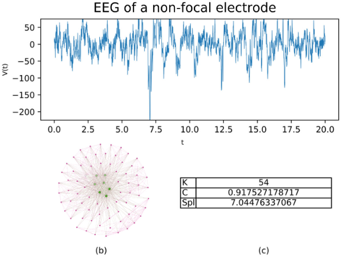 Identification of focal epileptic regions from electroencephalographic ...