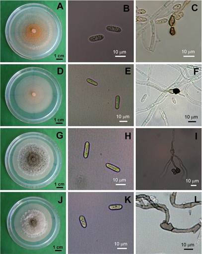 Antracnosis (Colletotrichum gloeosporioides Penz.) del fruto de litchi ...