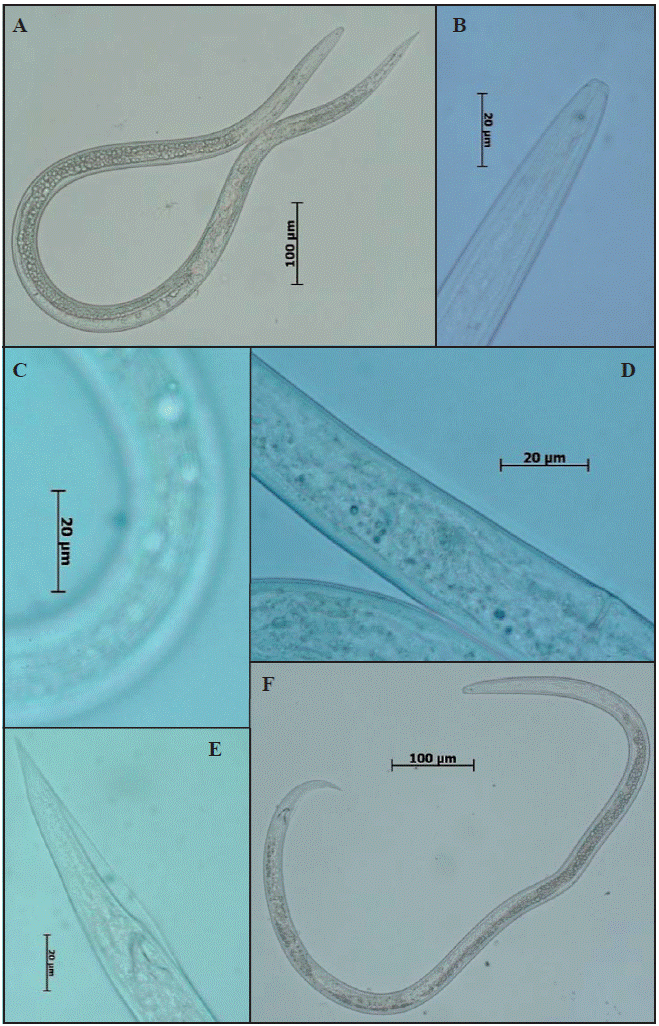 Detección, identificación e inferencia filogenética del nematodo del ...