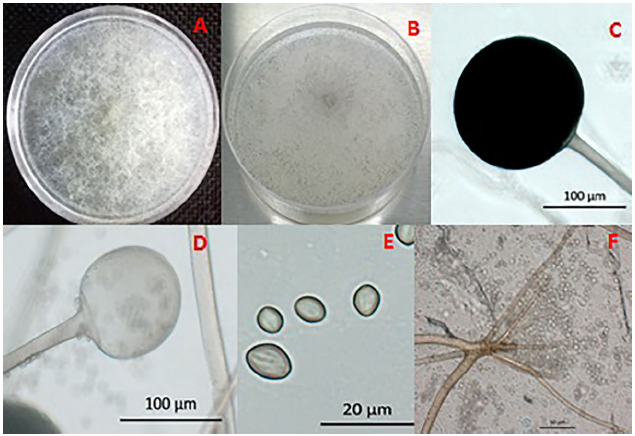 Mucor Spp Colony Morphology