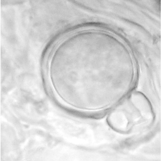 Tipos de compatibilidad A1 y A2 de Phytophthora capsici y P. drechsleri ...