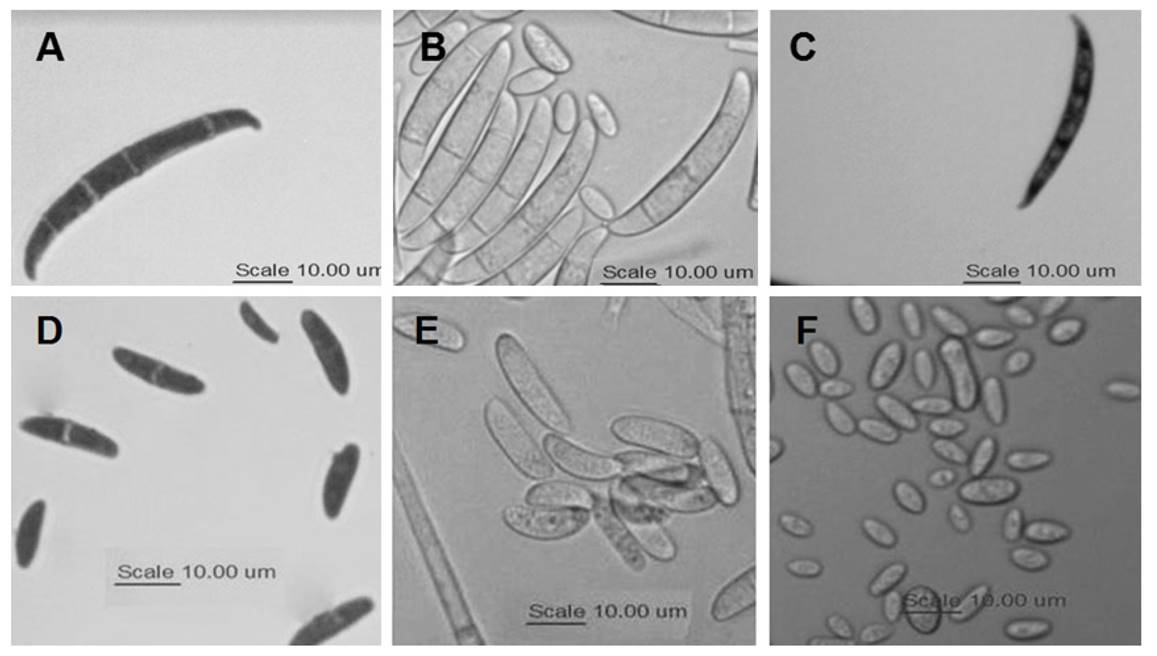Descripción y comparación entre morfotipos de Fusarium brachygibbosum ...