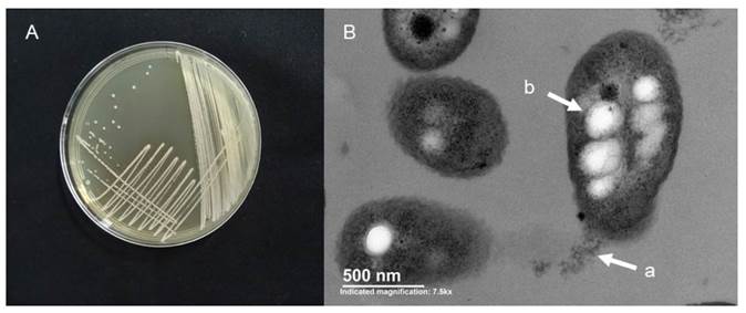 El género Burkholderia: entre el mutualismo y la patogenicidad