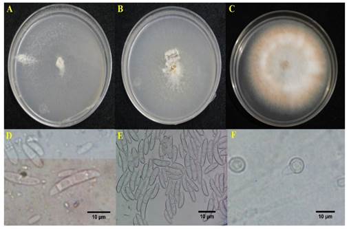 Fusarium sp., causal agent of vascular wilt in citrus and its ...