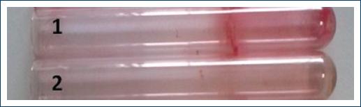 Comparative study between diarrheagenic Escherichia coli virotypes from ...