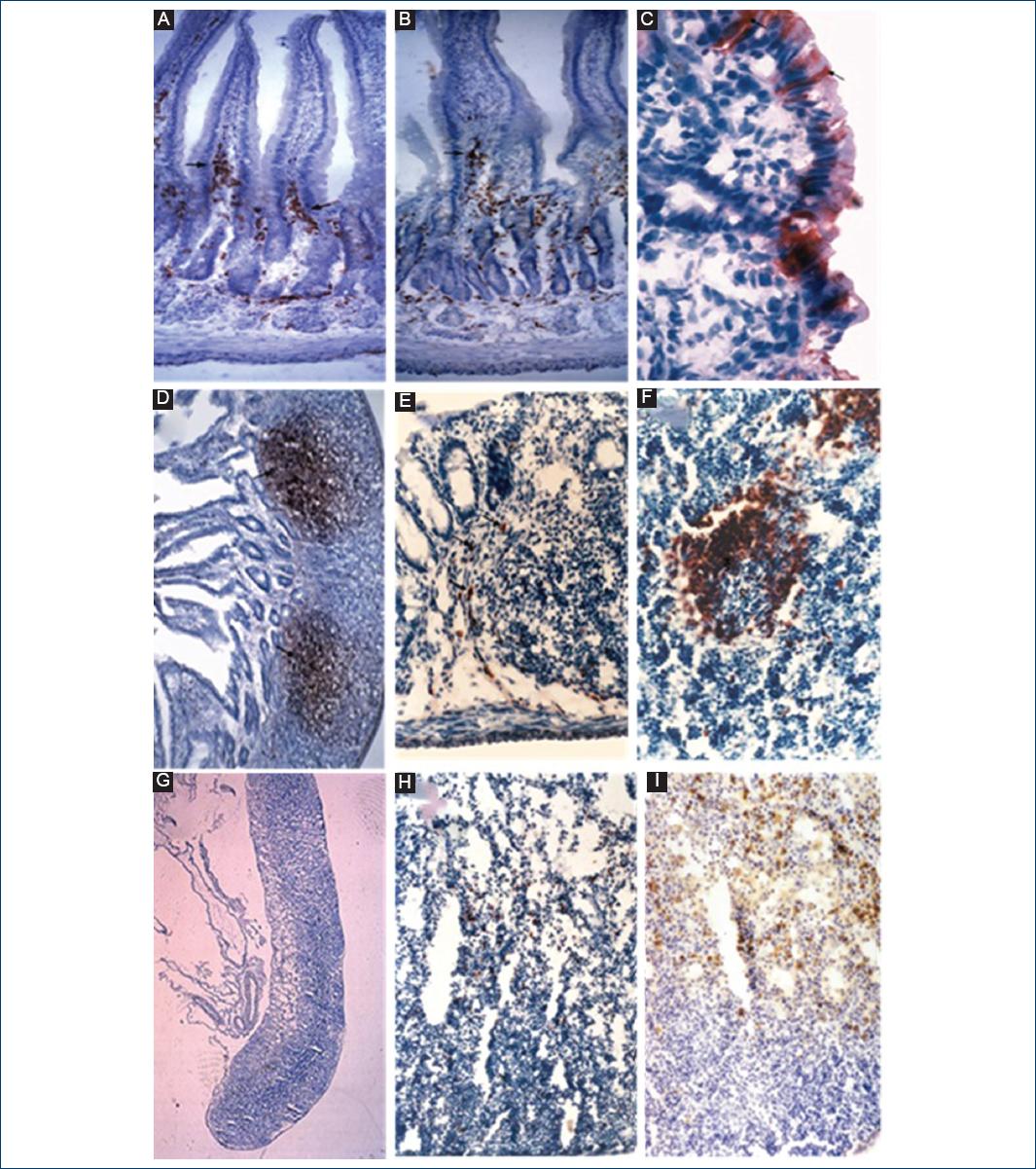 Development of the intestinal immune response in the suckling rat model ...