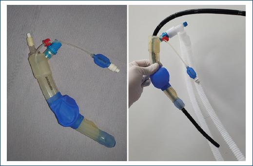 Endoscopy anesthesia, team perspective