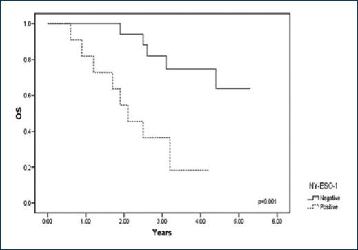 Frequency and clinical association of NY-ESO-1 gene expression in ...