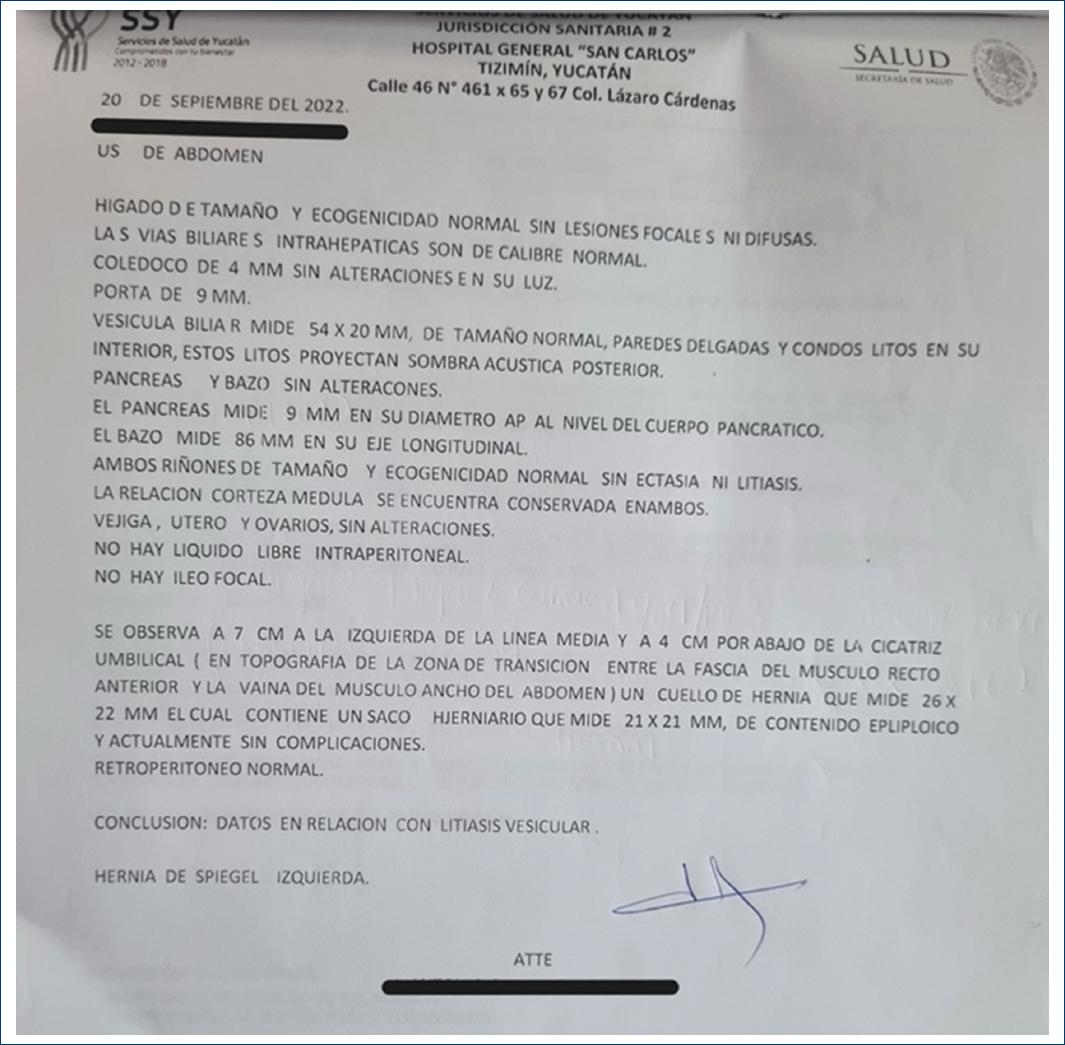 Spigelian hernia, a case series of four cases and literature review