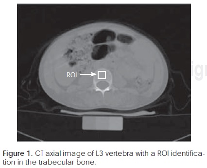 Trabecular bone: texture analysis in CT to improve osteoporosis ...