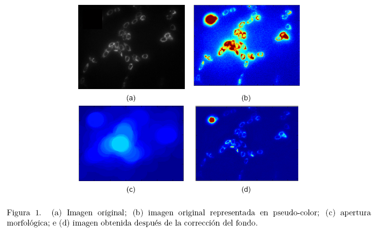 Análisis de la variación del calcio intracelular en células foliculares