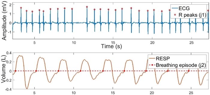 Characterization of the respiratory pattern in patients with chronic ...