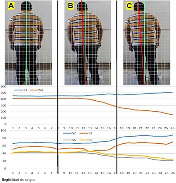 Evaluación De La Postura