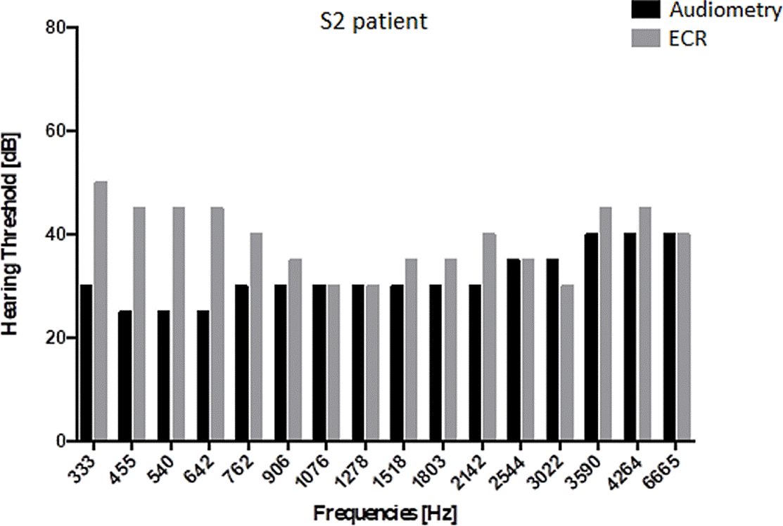 Electrical Cochlear Response as an Objective Measure of Hearing ...